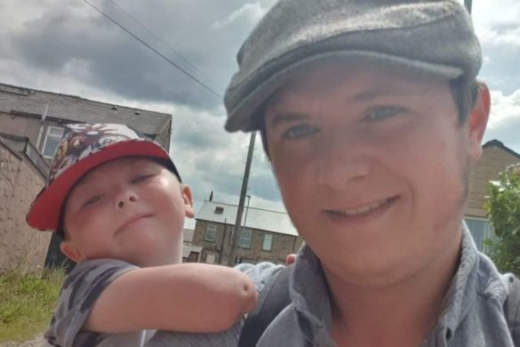 Chlapec se narodil bez předloktí, lidé se mu složili na bionickou ruku ...